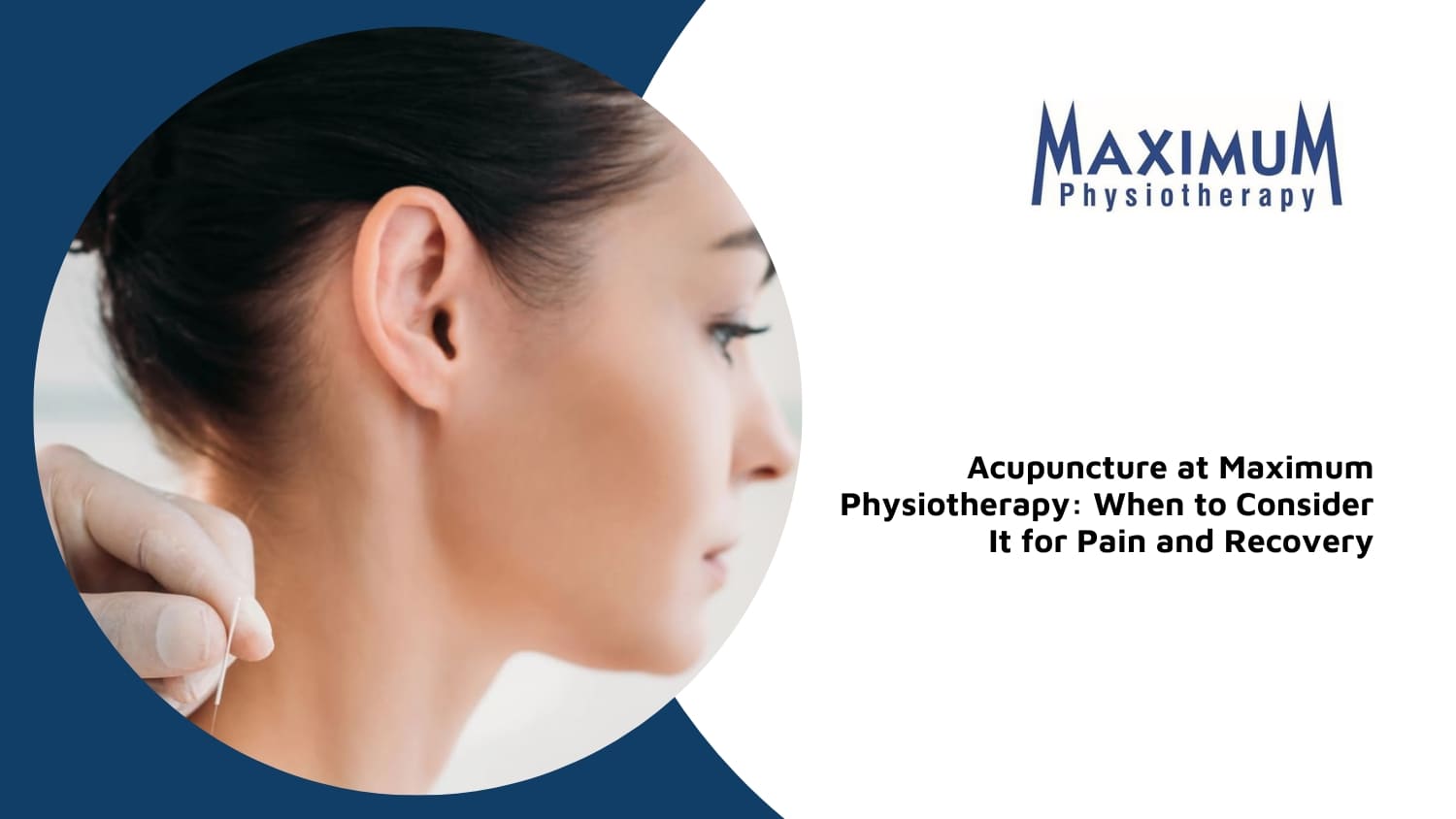Acupuncture at Maximum Physiotherapy: When to Consider It