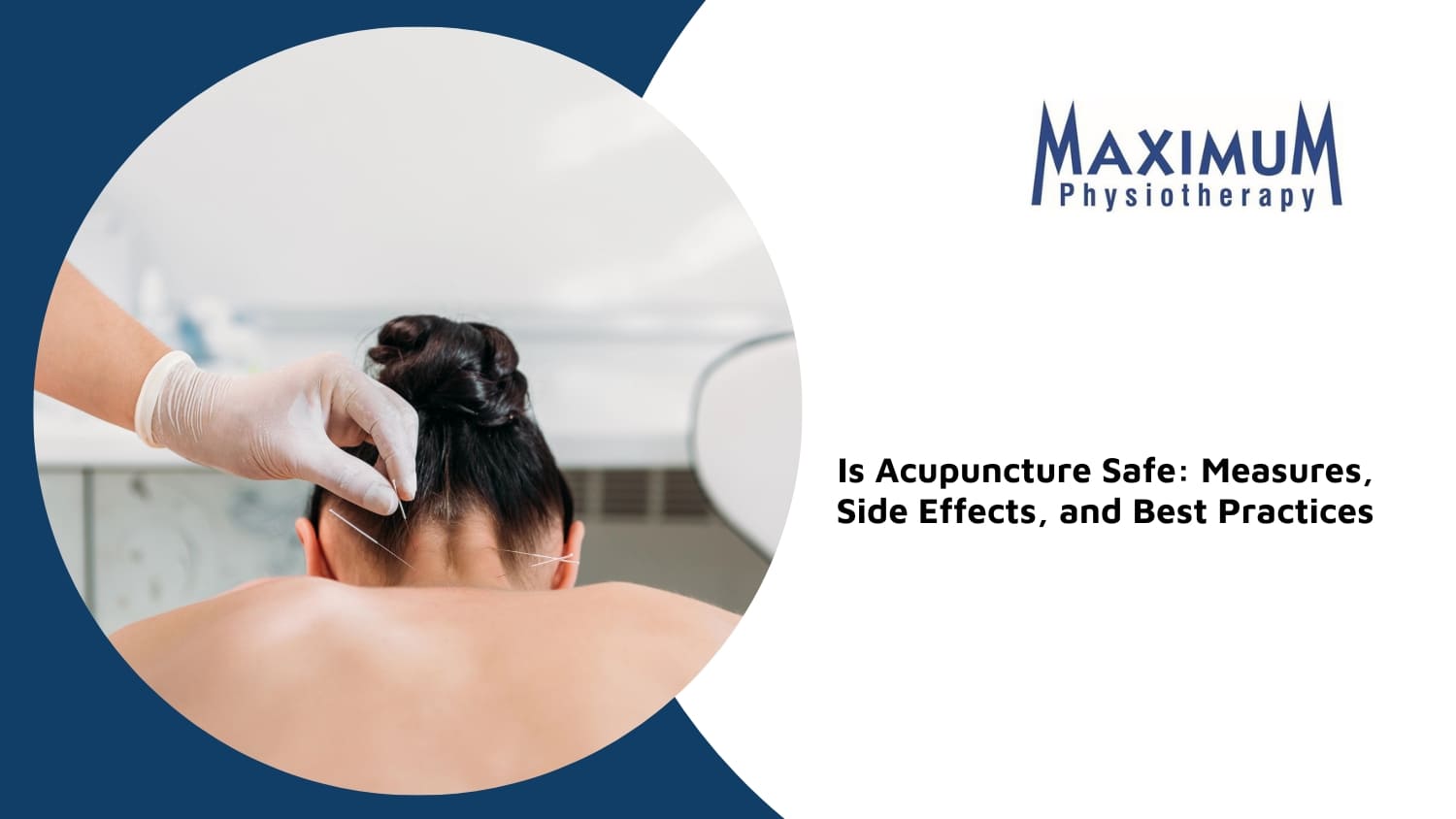 Is Acupuncture Safe: Measures, Side Effects, and Best Practices